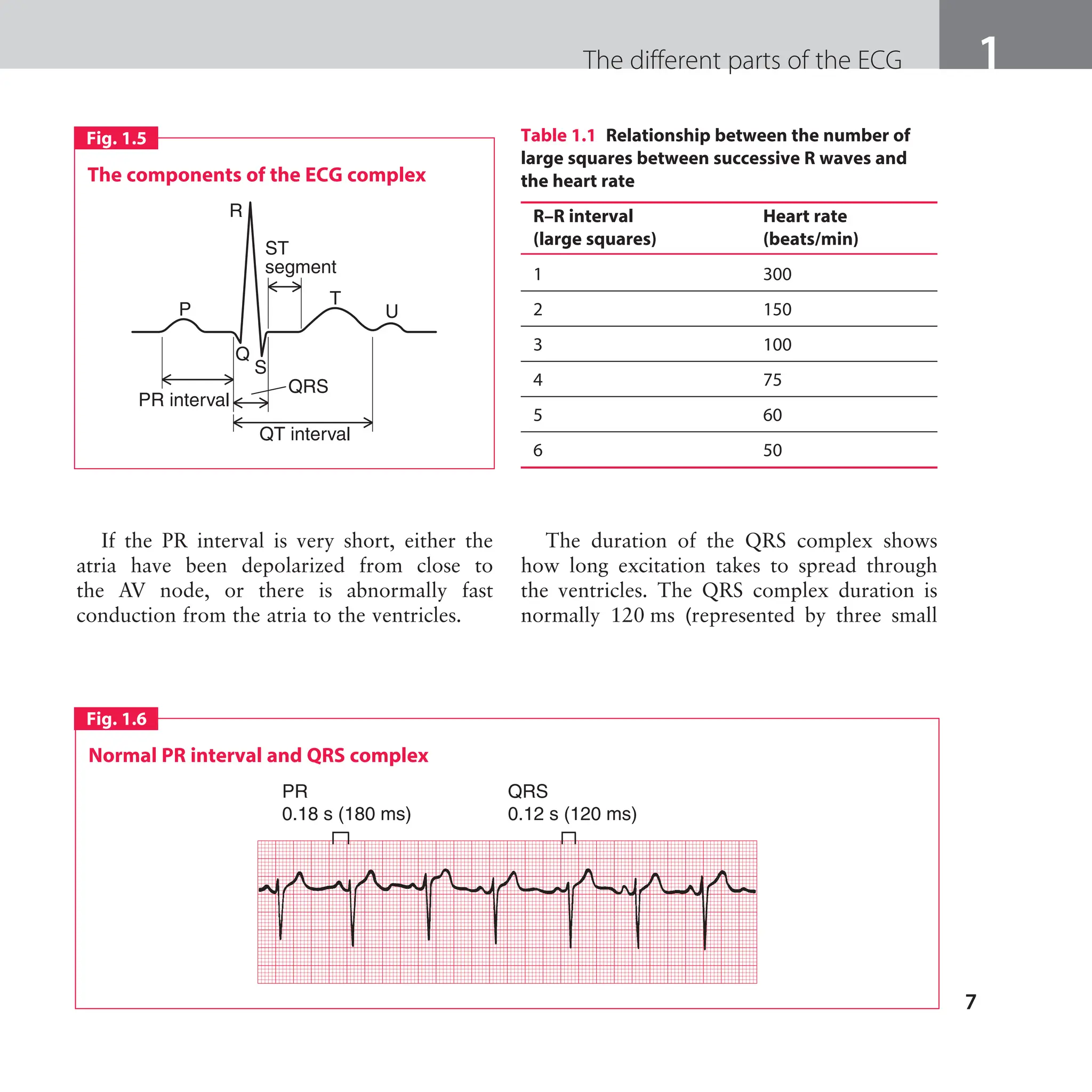 The ECG made easy guide. Guide on how to read ECG's quick and ...