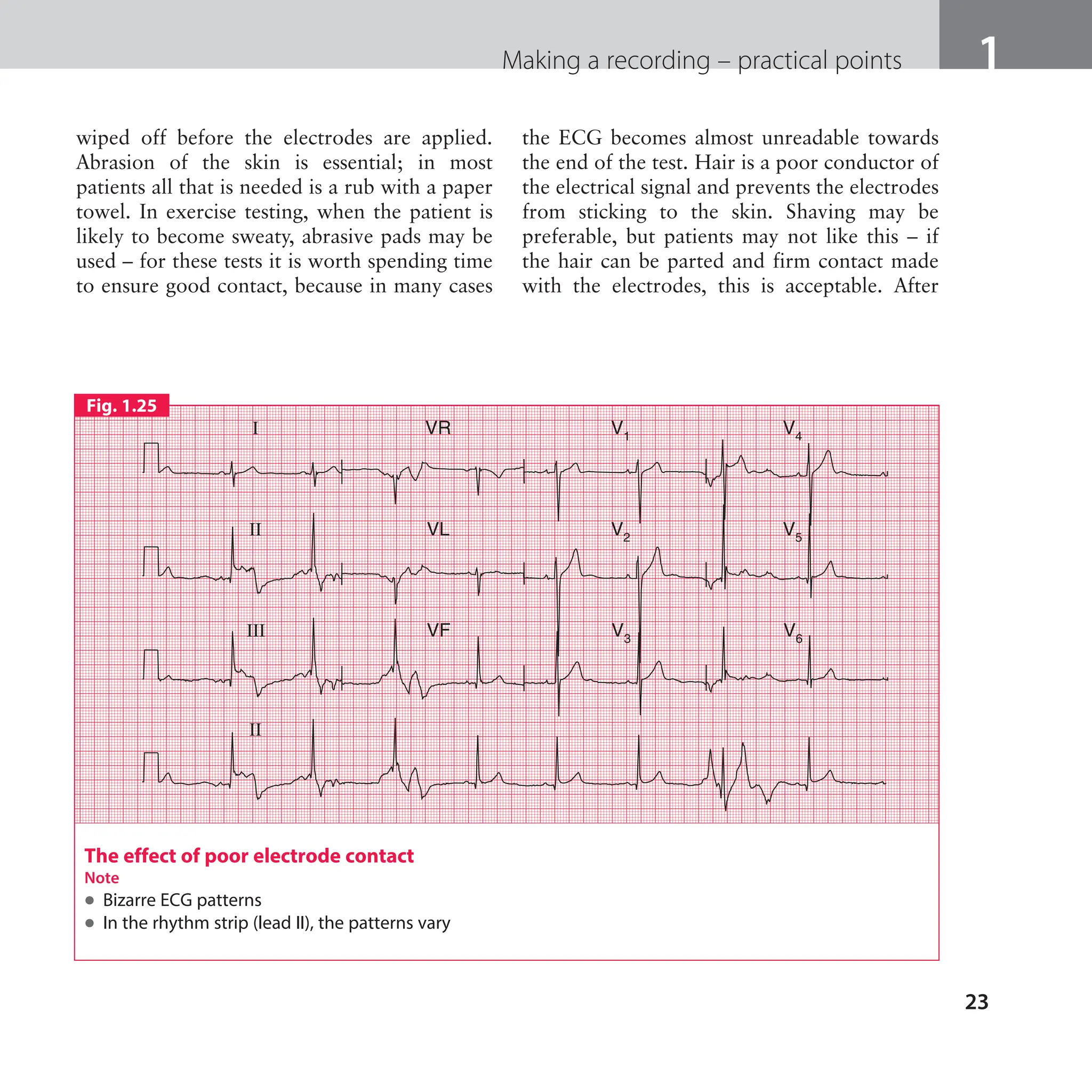 The ECG made easy guide. Guide on how to read ECG's quick and ...