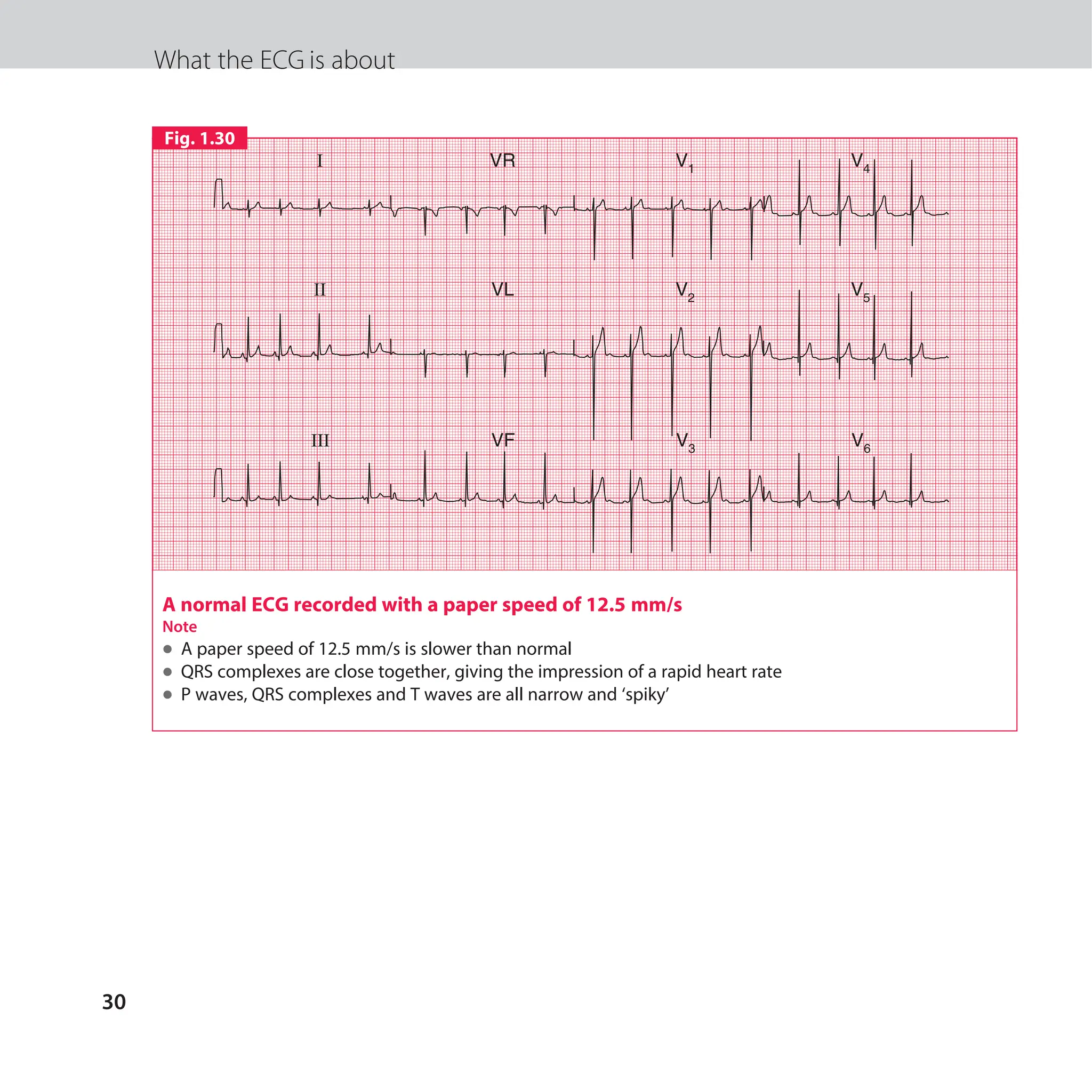 The ECG made easy guide. Guide on how to read ECG's quick and ...