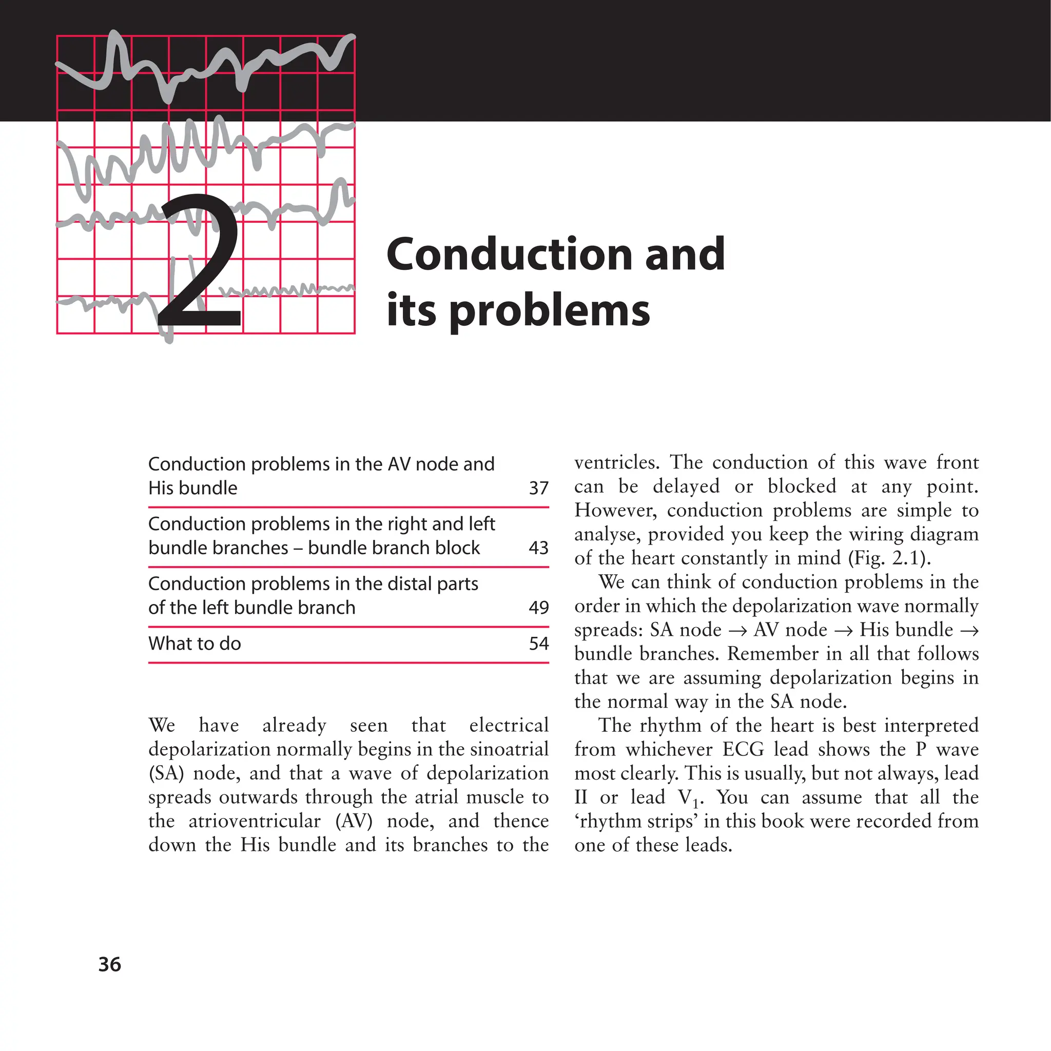 The ECG made easy guide. Guide on how to read ECG's quick and ...