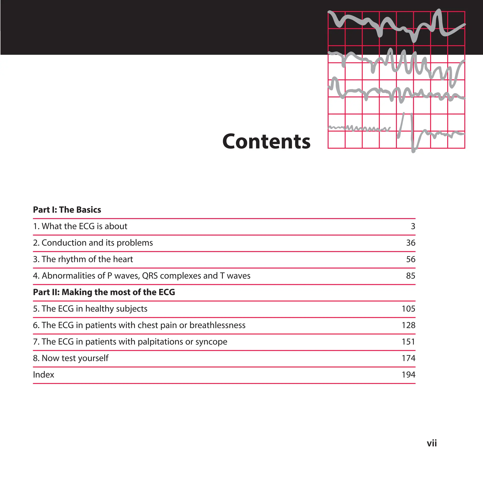 The ECG made easy guide. Guide on how to read ECG's quick and ...