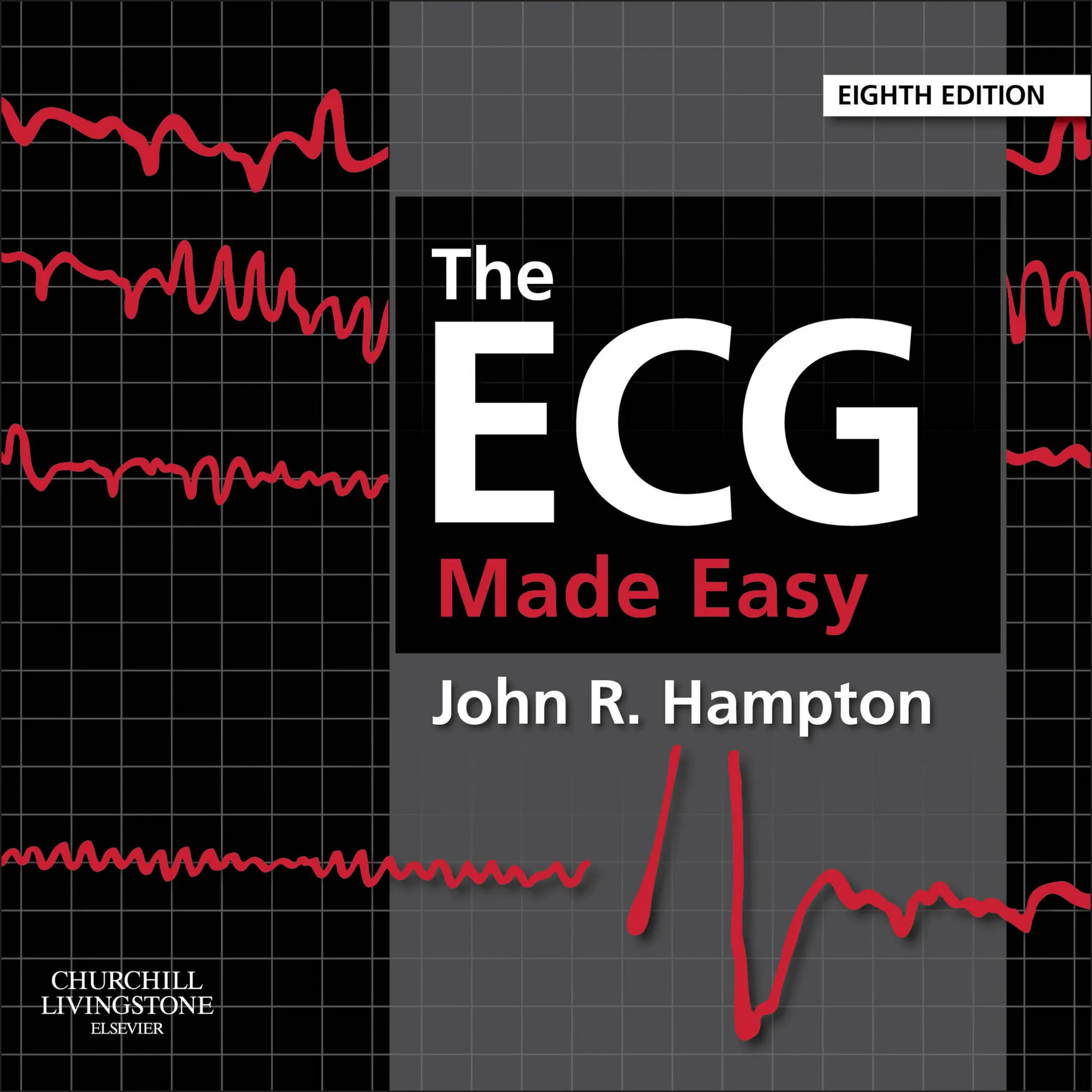The ECG made easy guide. Guide on how to read ECG's quick and ...