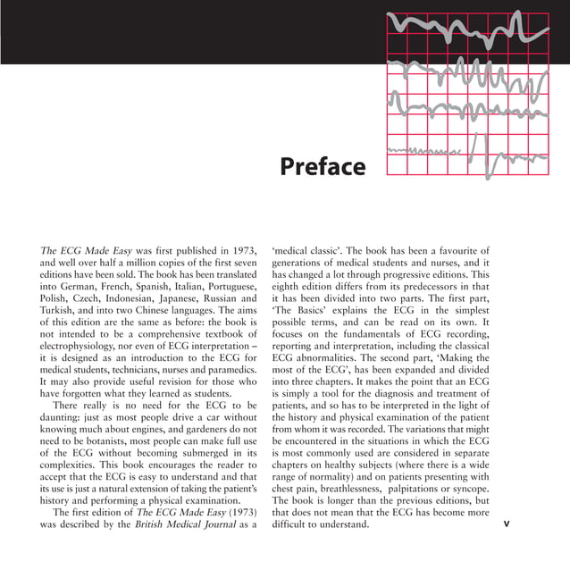 The ECG made easy guide. Guide on how to read ECG's quick and ...