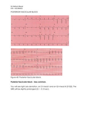 Ecg made easy by pokhrel, bharat | PDF