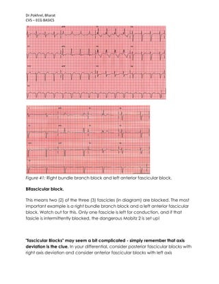 Ecg made easy by pokhrel, bharat | PDF