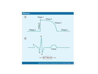 ECG manifestations of drug overdose | PPT