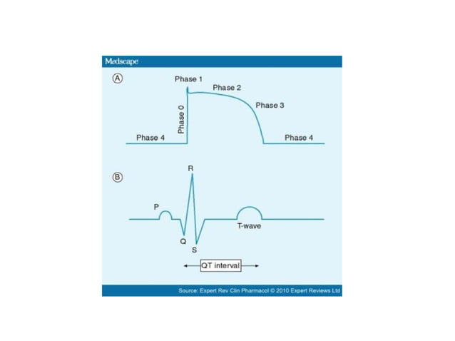 ECG manifestations of drug overdose | PPT