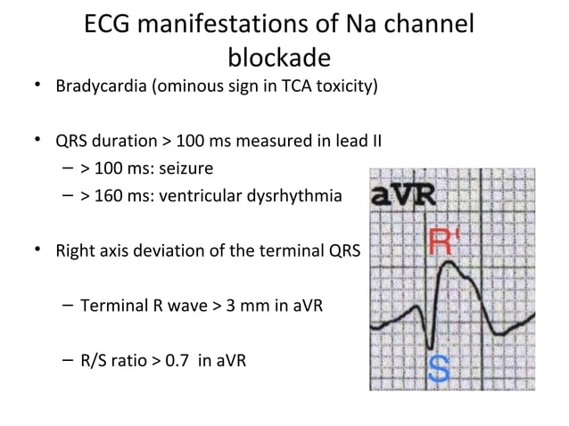 ECG manifestations of drug overdose | PPT