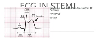 ECG Myocardial Infarction medicine lecture.pptx