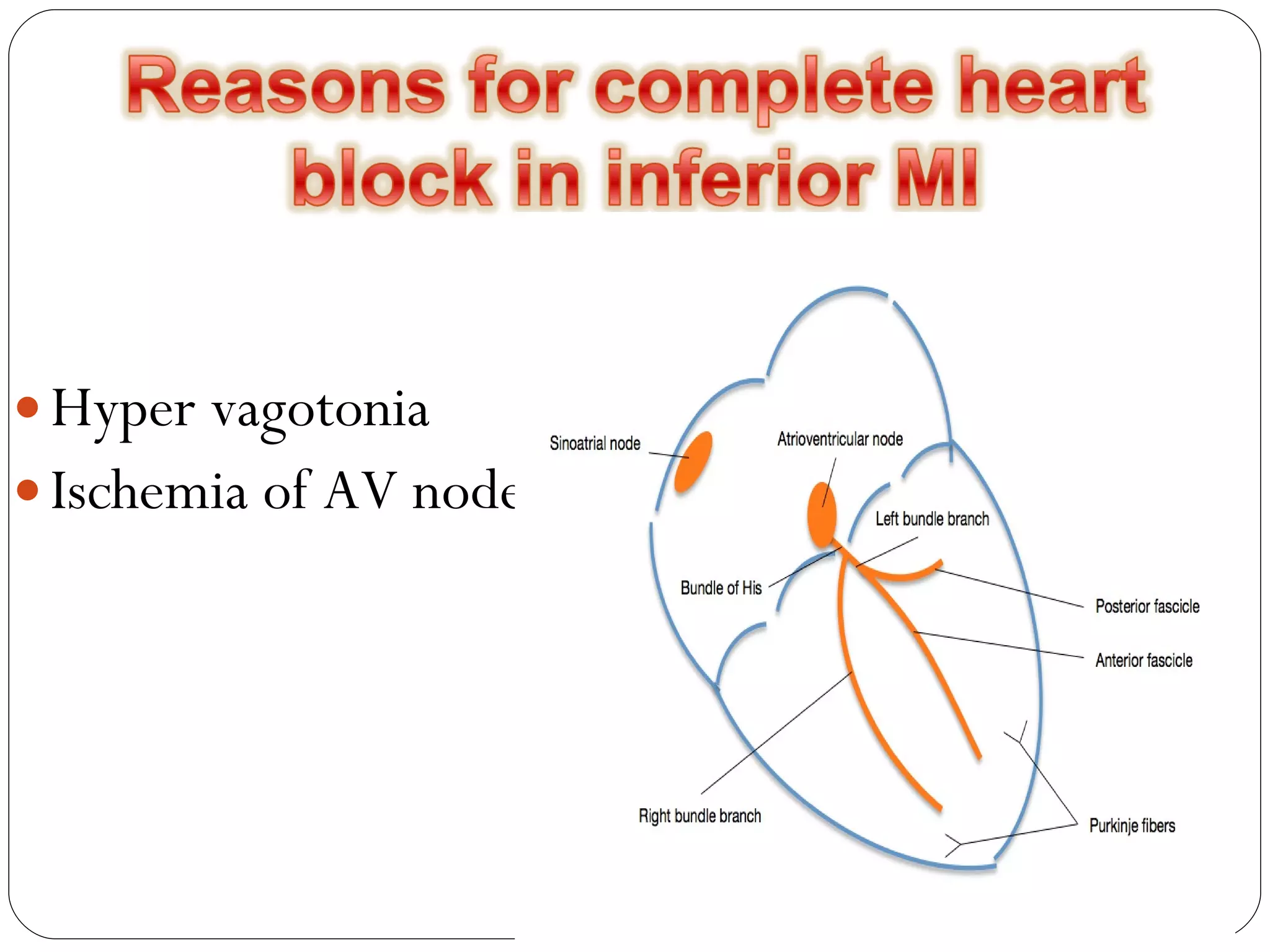 ECG: Myocardial Infarction with CHB | PPT