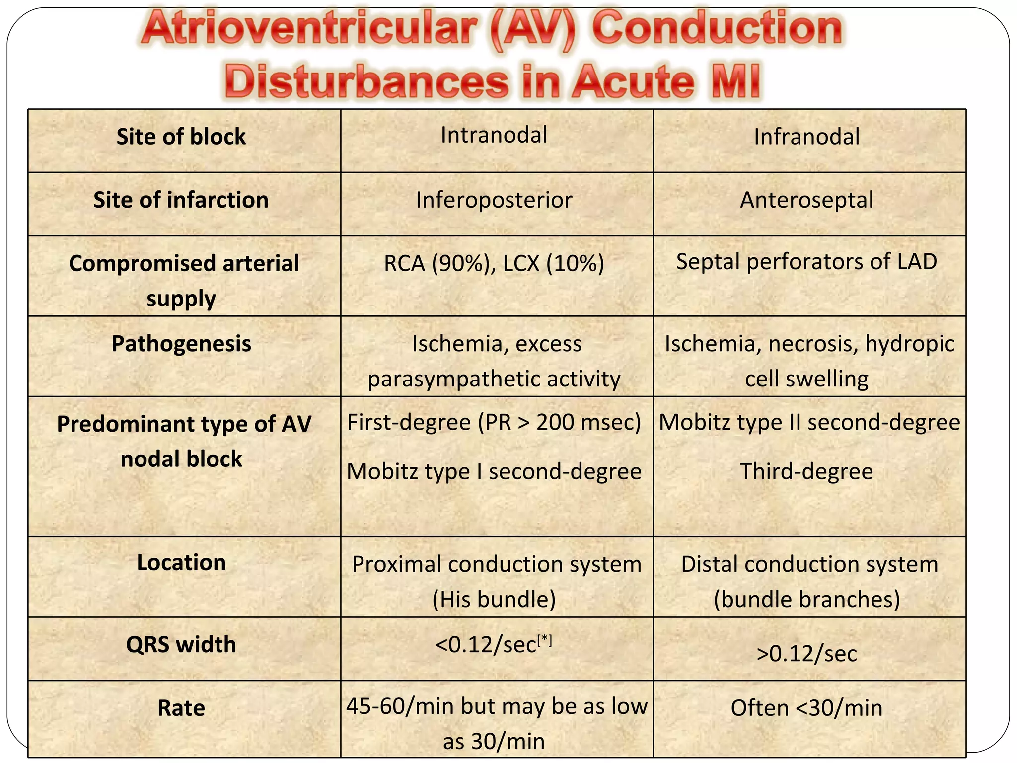 ECG: Myocardial Infarction with CHB | PPT