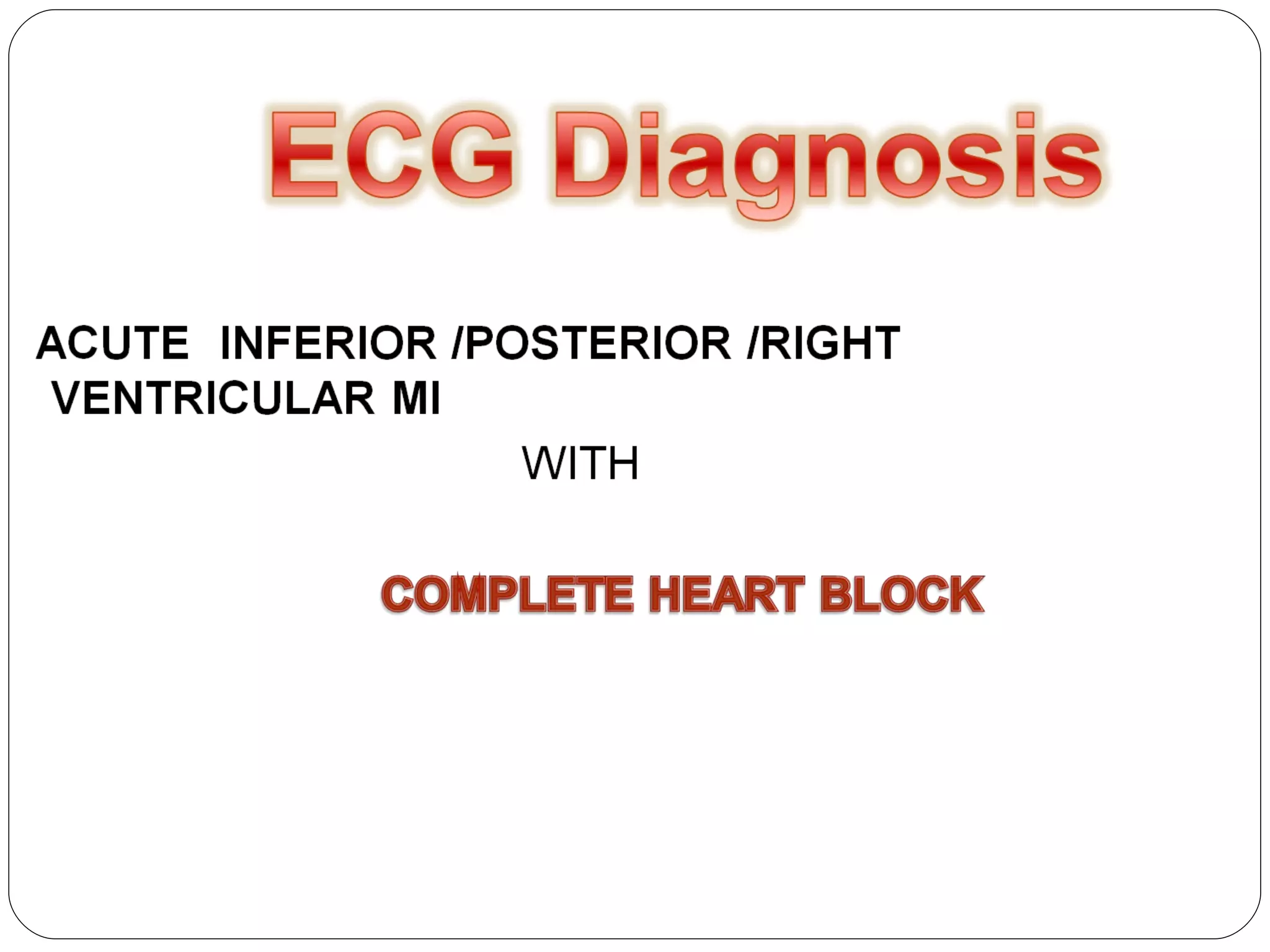 ECG: Myocardial Infarction with CHB | PPT