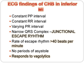 ECG: Myocardial Infarction with CHB | PPT