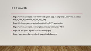 ECG | PPT