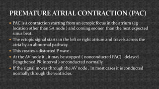 ECG Monitoring (Basic of ECG) | PPTX