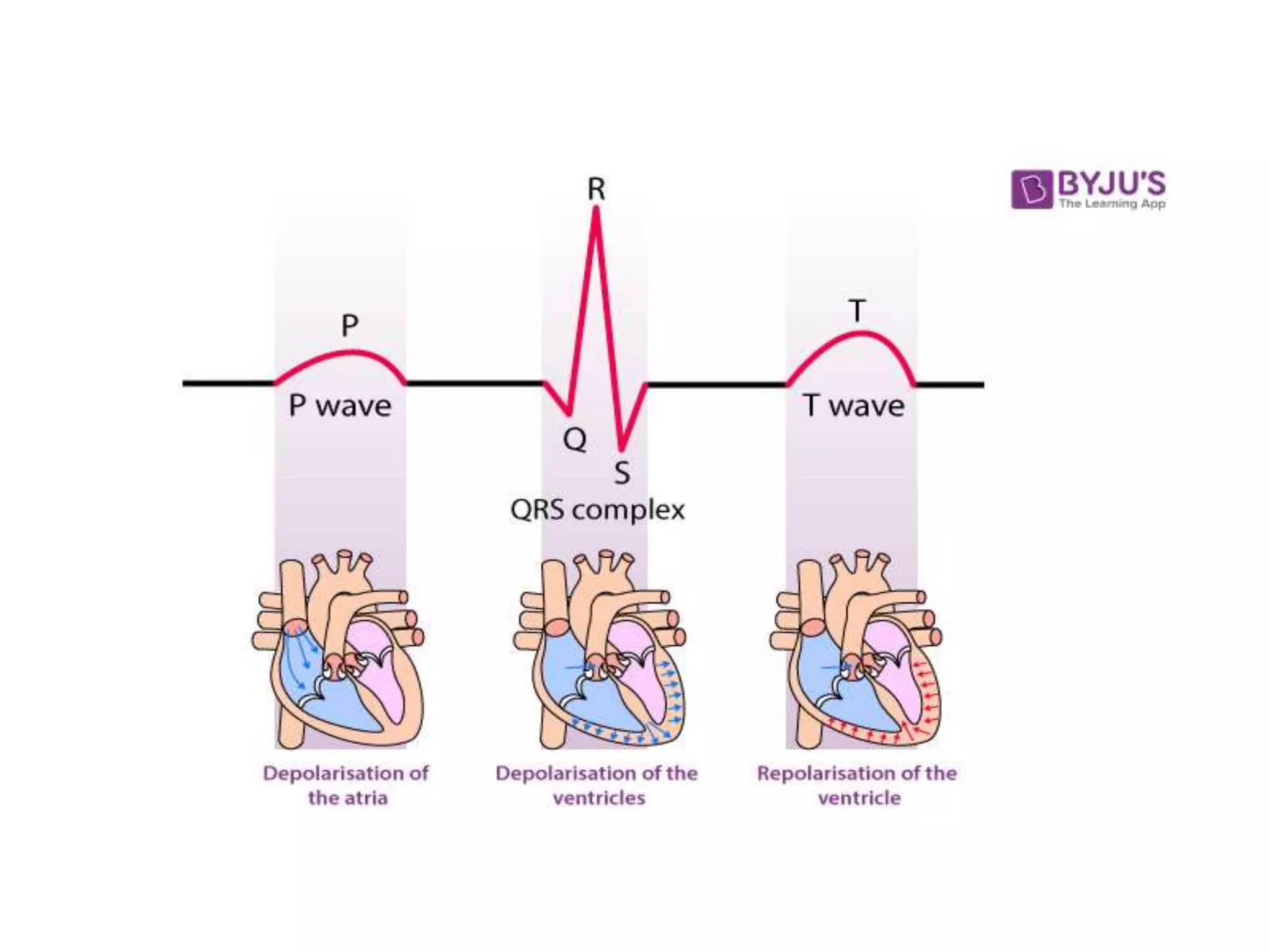 ECG MONITORING AND ECG CHANGES OF INTRAOPERATIVE MYOCARDIAL.pptx