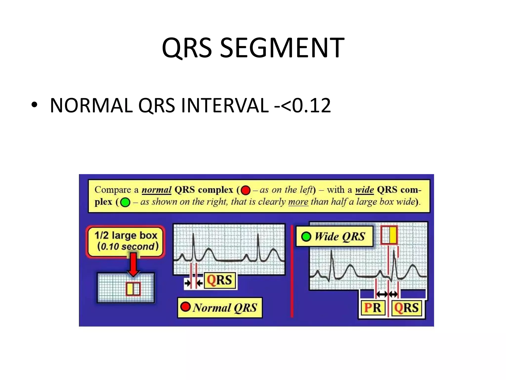 ECG MONITORING AND ECG CHANGES OF INTRAOPERATIVE MYOCARDIAL.pptx