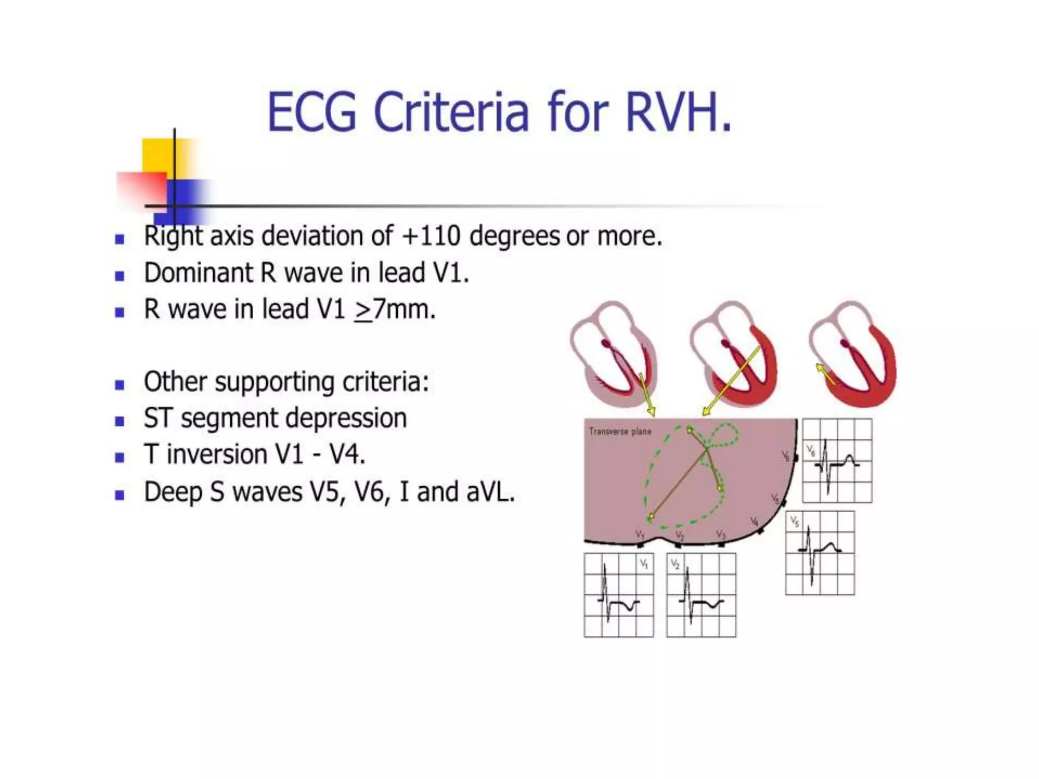 ECG MONITORING AND ECG CHANGES OF INTRAOPERATIVE MYOCARDIAL.pptx