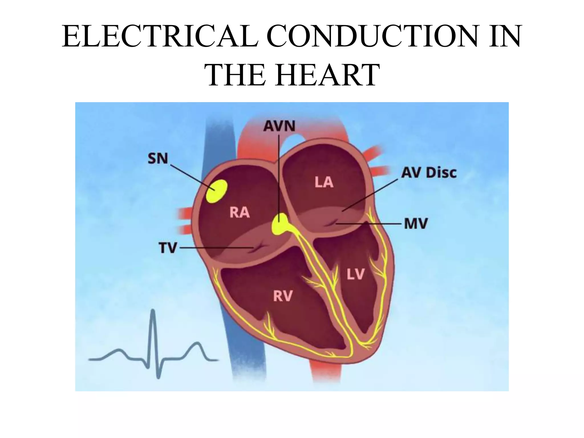 ECG MONITORING AND ECG CHANGES OF INTRAOPERATIVE MYOCARDIAL.pptx