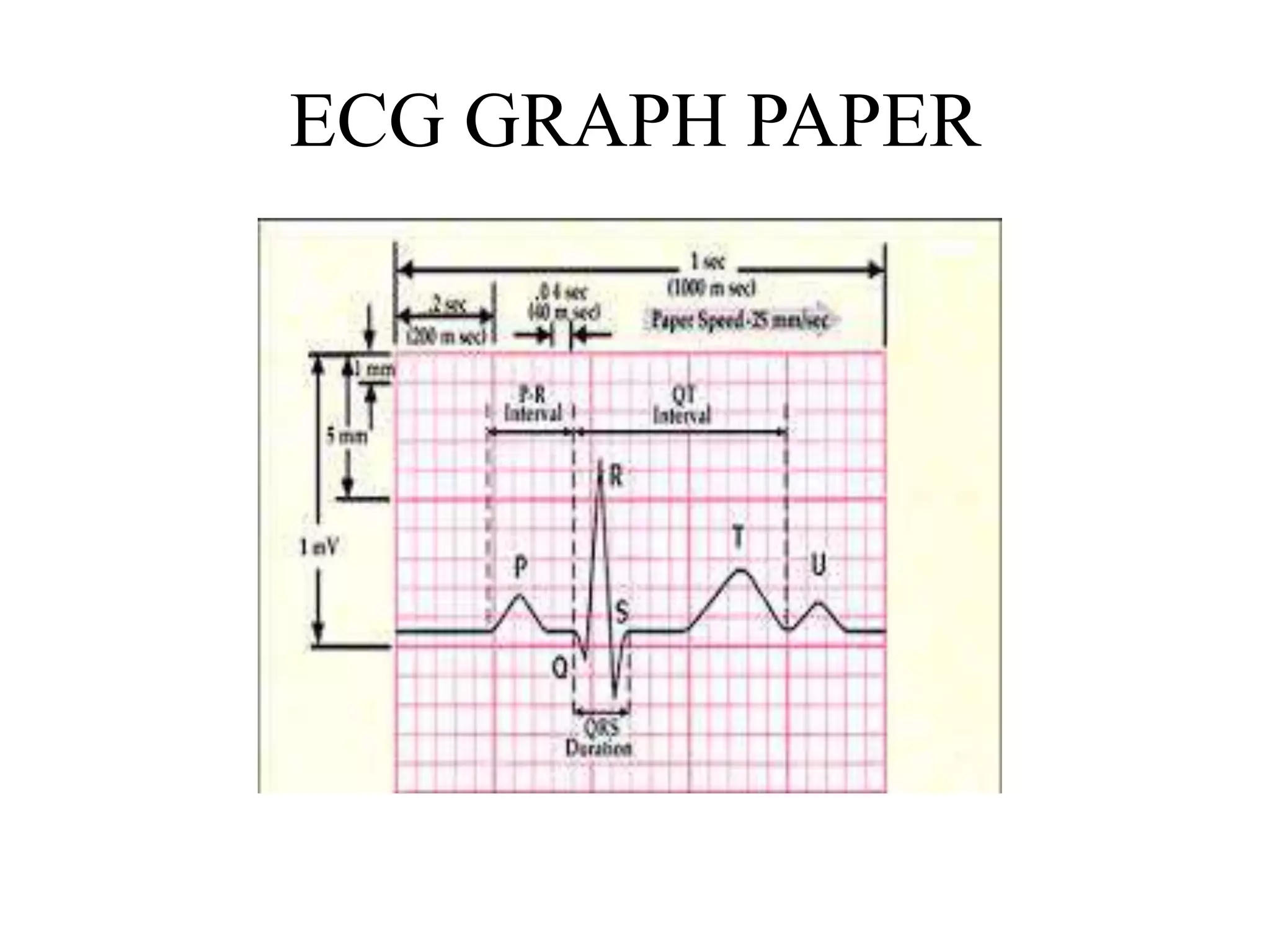 ECG MONITORING AND ECG CHANGES OF INTRAOPERATIVE MYOCARDIAL.pptx