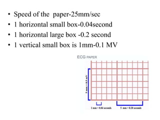 ECG MONITORING AND ECG CHANGES OF INTRAOPERATIVE MYOCARDIAL.pptx