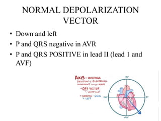 ECG MONITORING AND ECG CHANGES OF INTRAOPERATIVE MYOCARDIAL.pptx