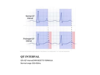 ECG MONITORING AND ECG CHANGES OF INTRAOPERATIVE MYOCARDIAL.pptx