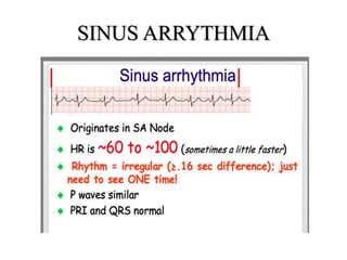 ECG MONITORING AND ECG CHANGES OF INTRAOPERATIVE MYOCARDIAL.pptx