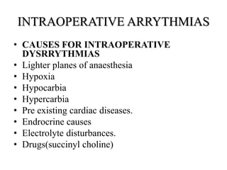ECG MONITORING AND ECG CHANGES OF INTRAOPERATIVE MYOCARDIAL.pptx
