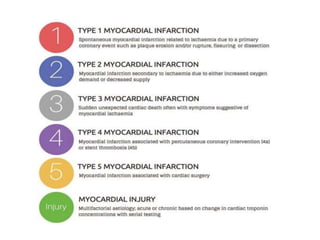ECG MONITORING AND ECG CHANGES OF INTRAOPERATIVE MYOCARDIAL.pptx