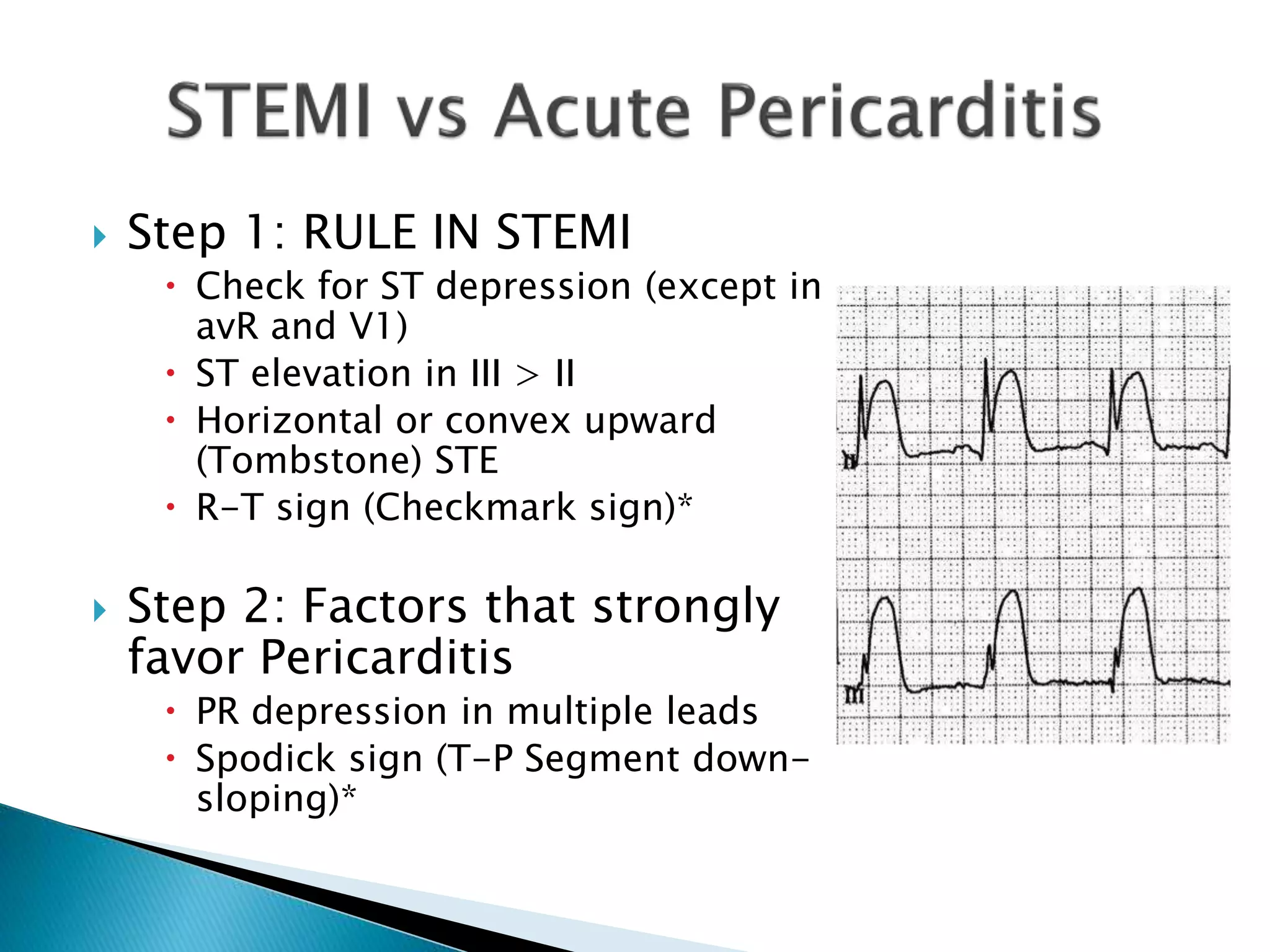 ECG Changes in Myocardial Infarction | PPTX