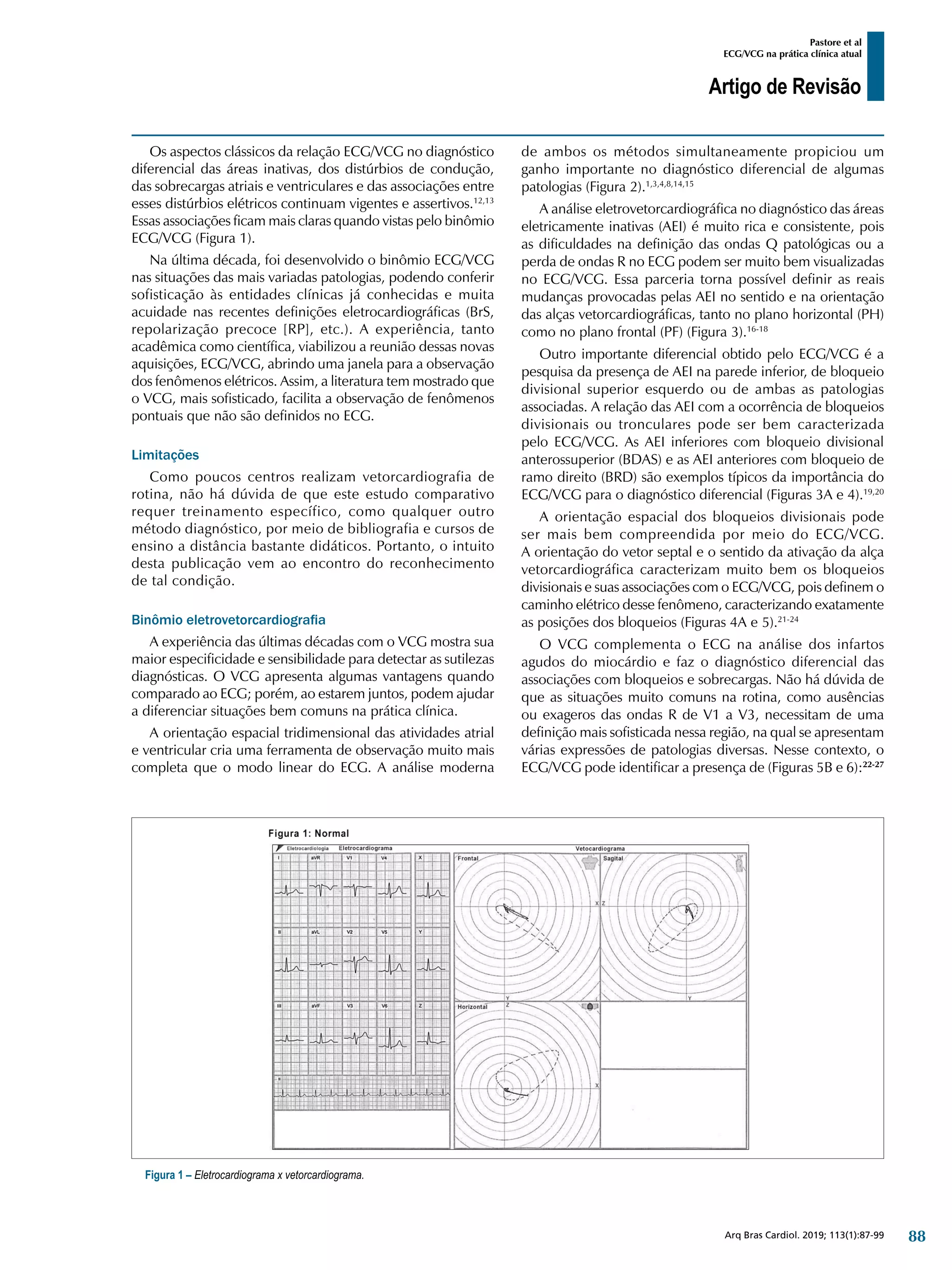 Ecg na pratica clinica | PDF