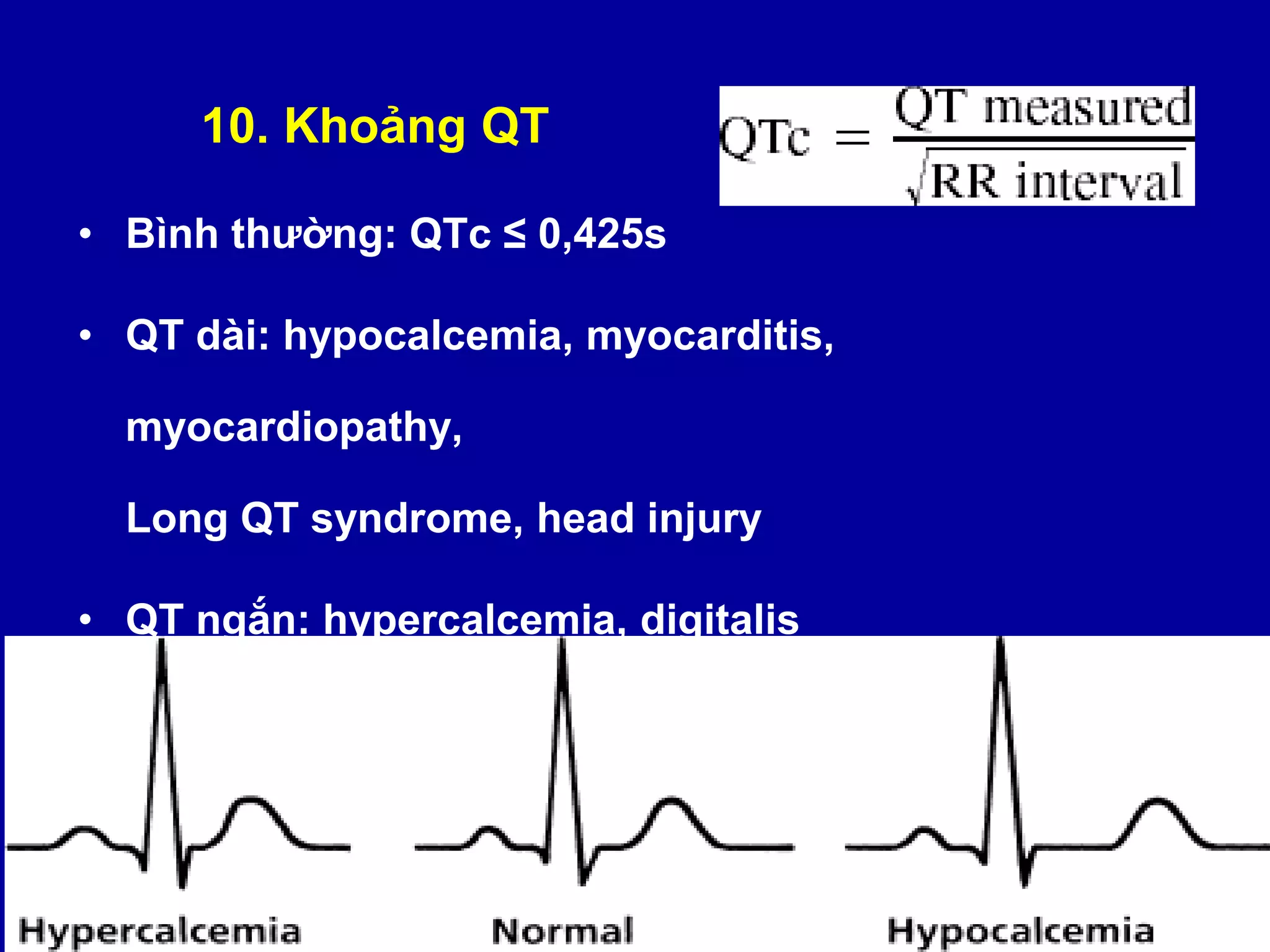 ECG NHI KHOA | PDF