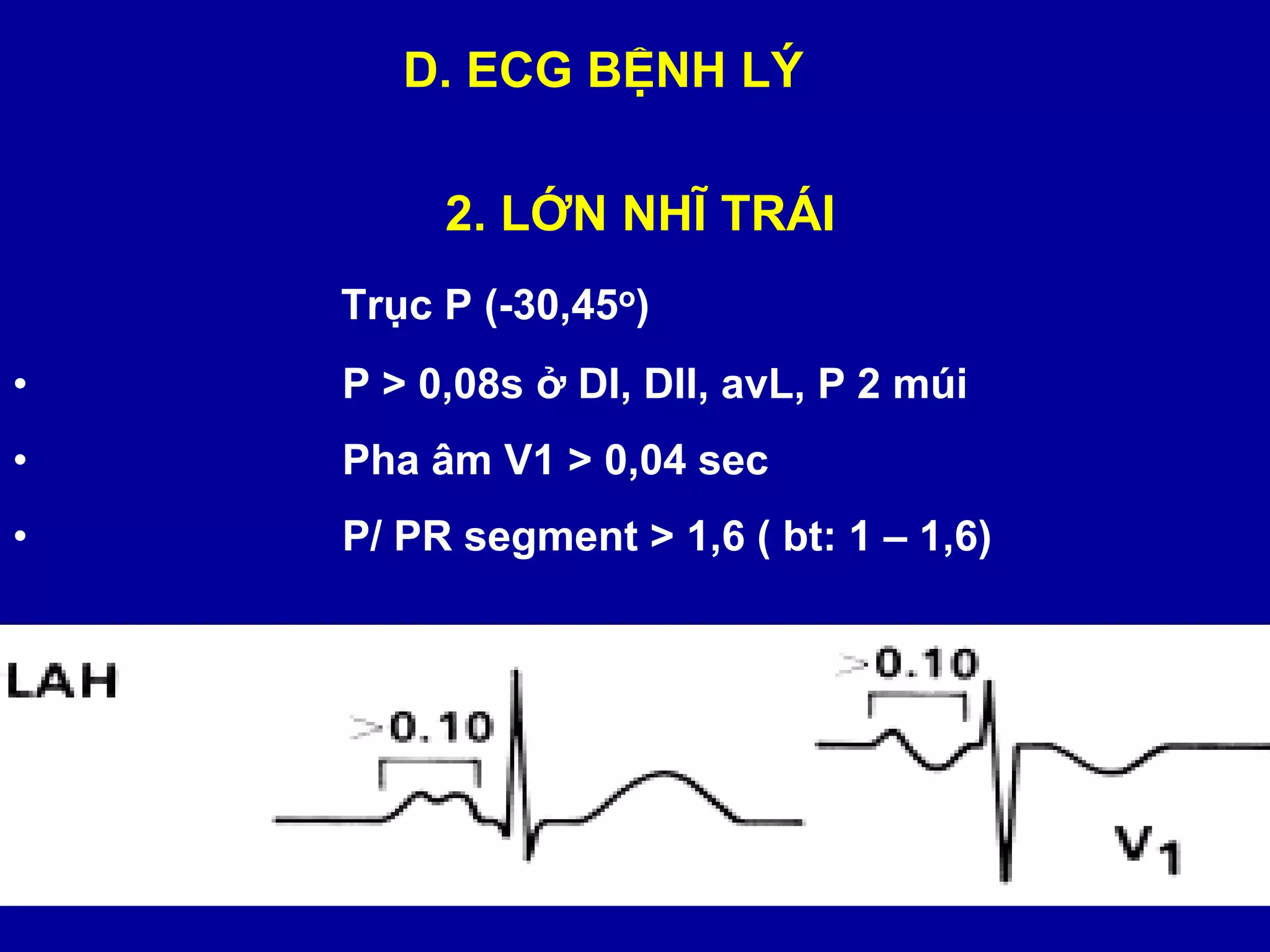 ECG NHI KHOA | PDF