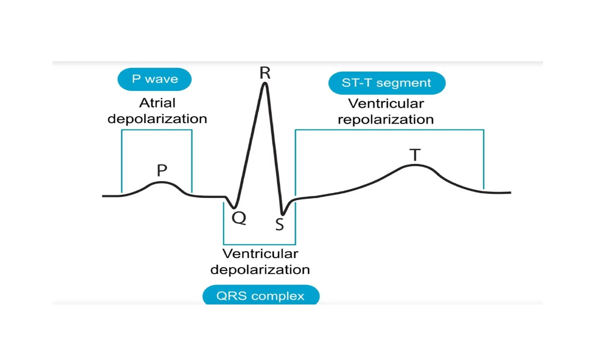 ELECTROCARDIOGRAM FOR MEDICAL STUDENTS IN SIMPLE | PPTX