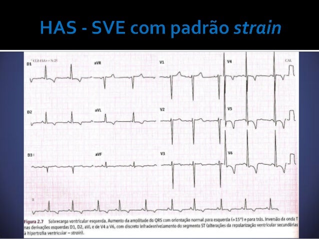 aula de Ecg no hospital geral eletrocardiograma