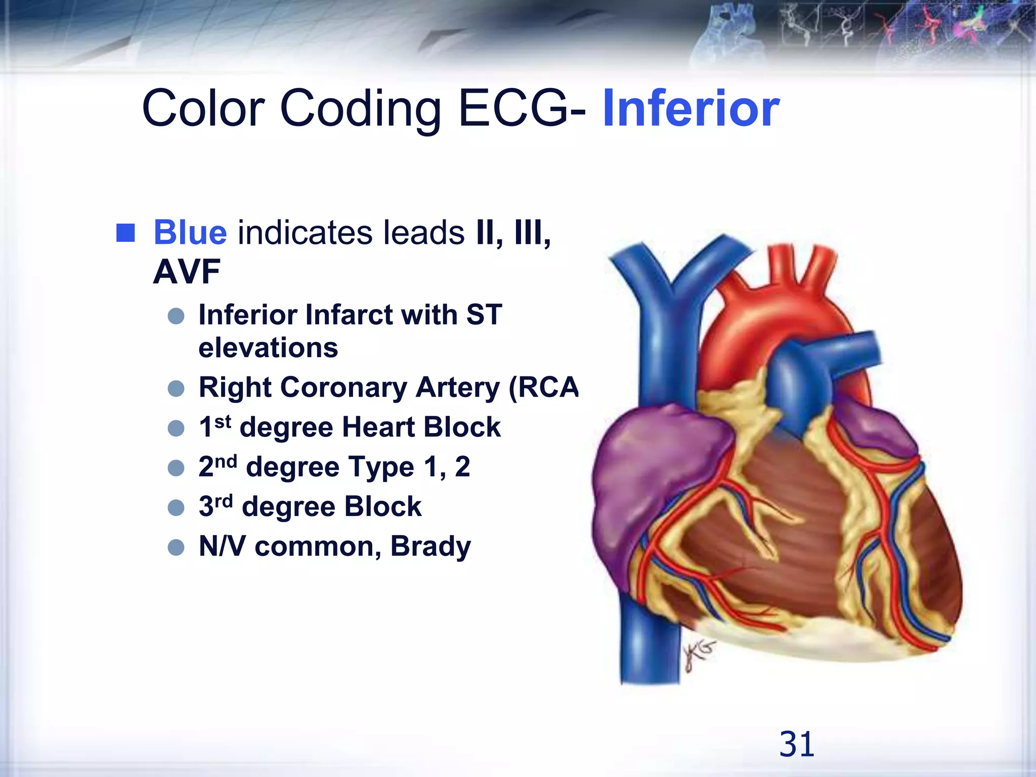 Зүрхний цахилгаан бичлэг | PPT | Heart and Cardiovascular Diseases ...