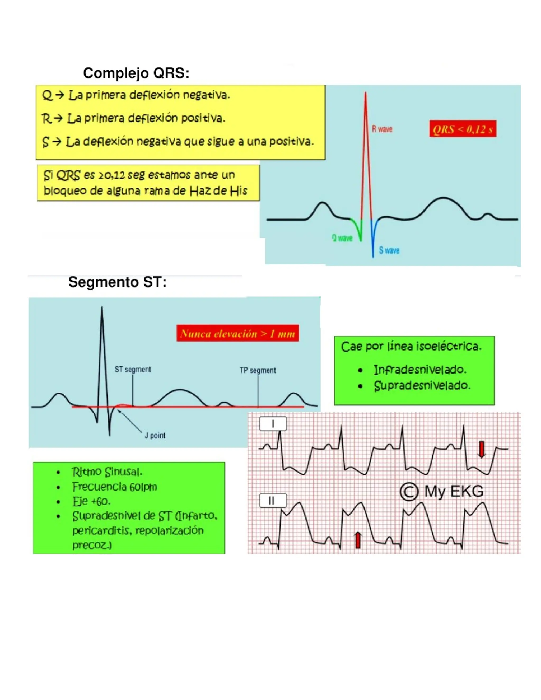 ECG Normal dr hulk 19 ig fb 333333333.docx