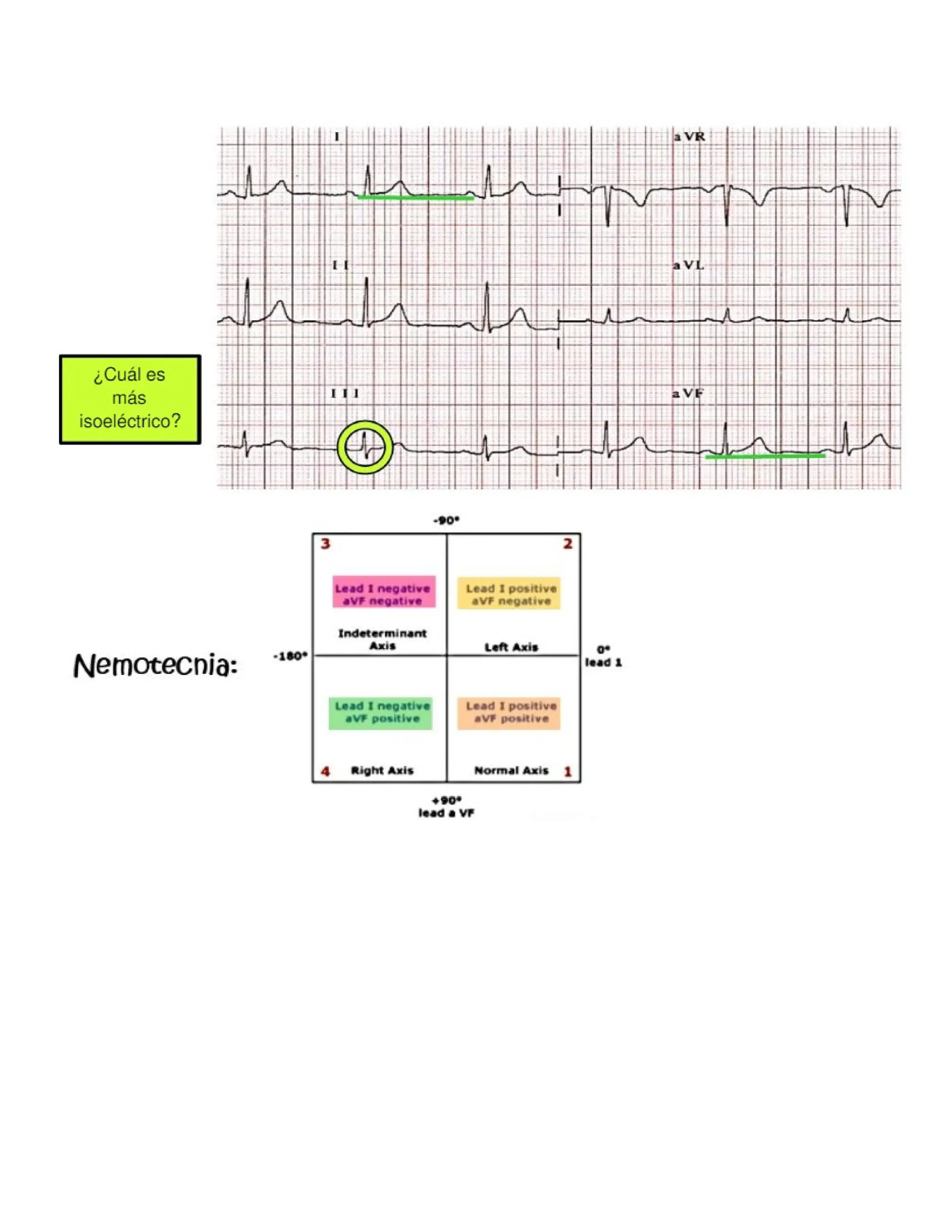 ECG Normal dr hulk 19 ig fb 333333333.docx