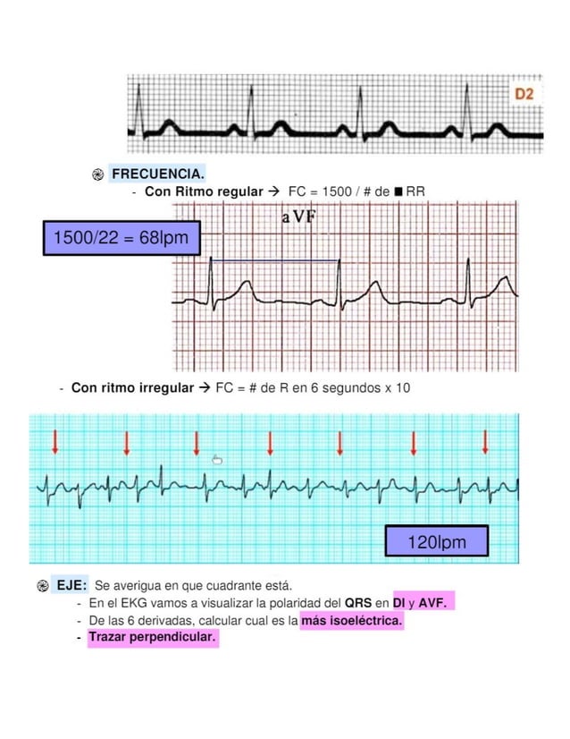 ECG Normal dr hulk 19 ig fb 333333333.docx