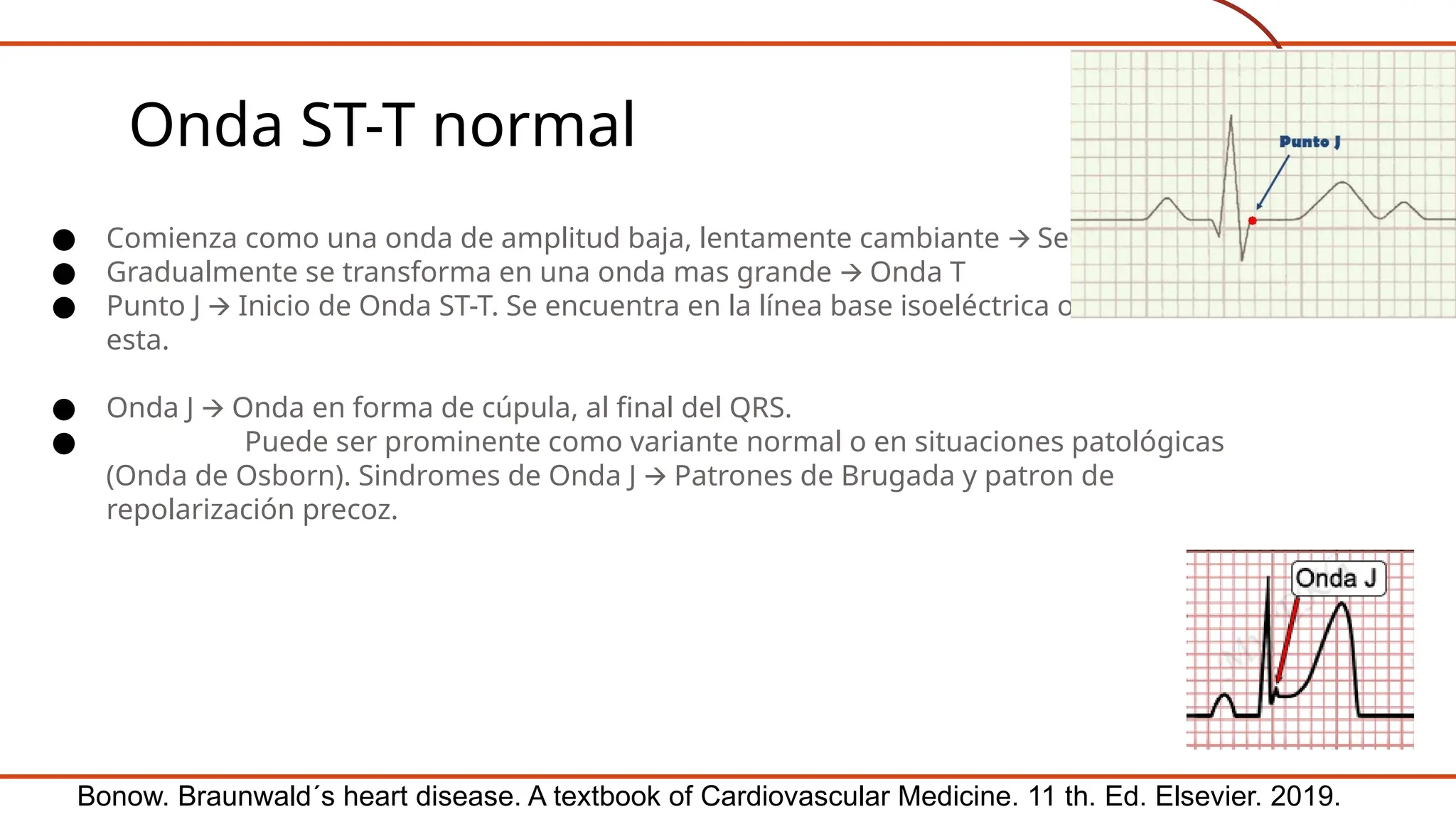 Electrocardiograma normal, PAra prinicpiantes | PPT
