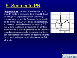 ELECTROCARDIOGRAFIA- Primero pasos para manejo de lectura | PPT