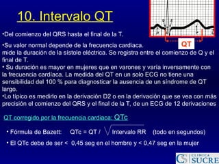 ELECTROCARDIOGRAFIA- Primero pasos para manejo de lectura | PPT