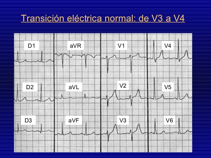 Ecg normal