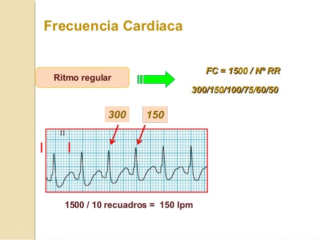 Electrocardiograma Normal