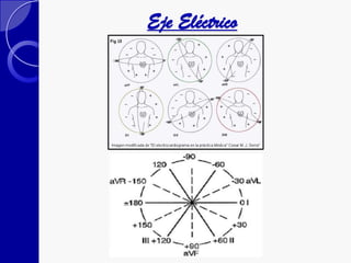 Ecg normal en pediatria | PPTX