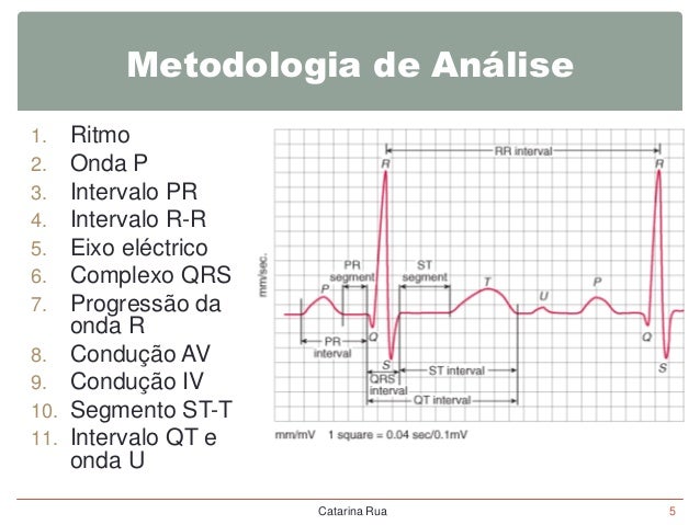 Ecg normalidade e variação de normalidade