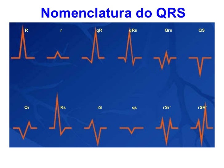 ECG NORMAL