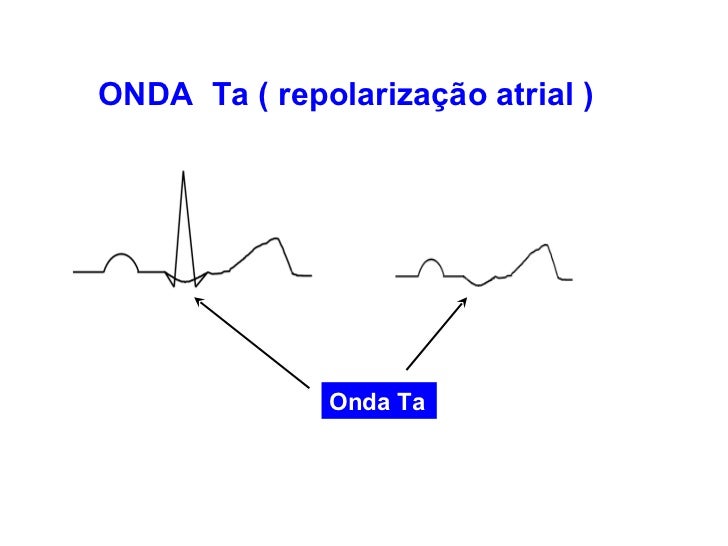ECG NORMAL