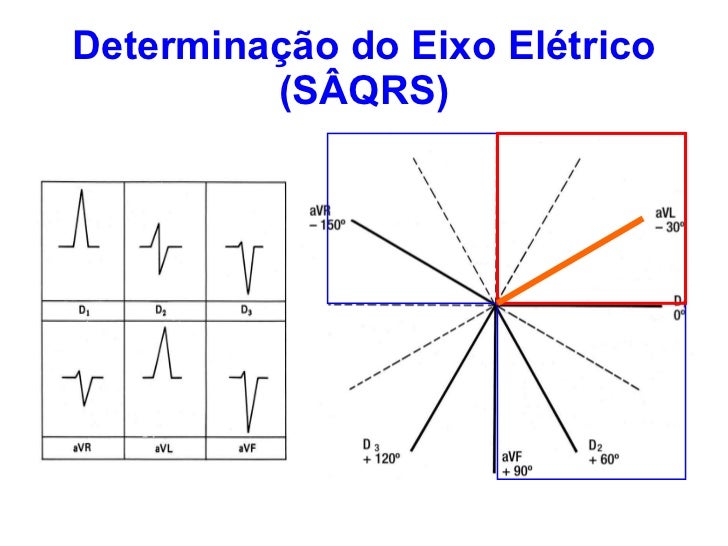 ECG NORMAL